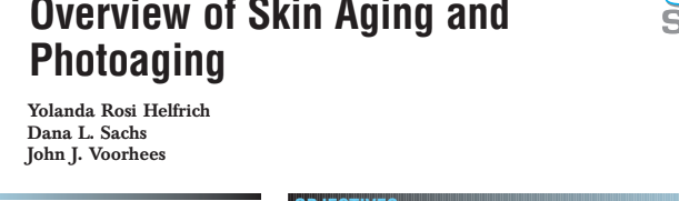 Overview of Skin Aging and Photoaging – MDRN